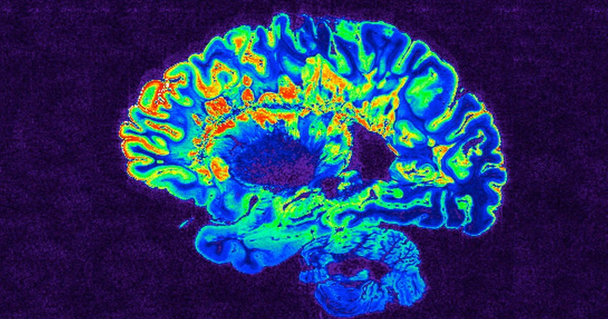 Frontiers in Integrative Neuroscience Study - Judith Orloff MD